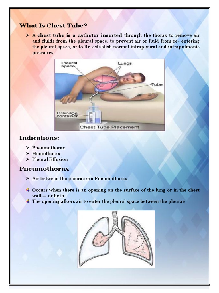 Hemothorax Chest Tube