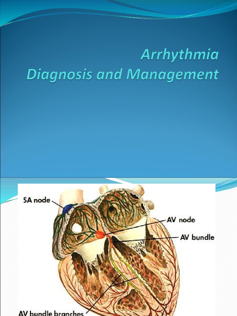 Arrhythmia Diagnosis and Management | PDF | Heart | Cardiac ...