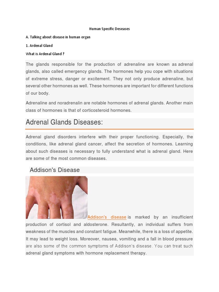 Adrenal Glands Diseases:: Addison's Disease | PDF | Hemorrhoid ...