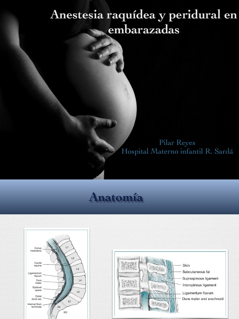 Anestesia en Embarazadas y Línea de Tuffier | PDF | El embarazo ...