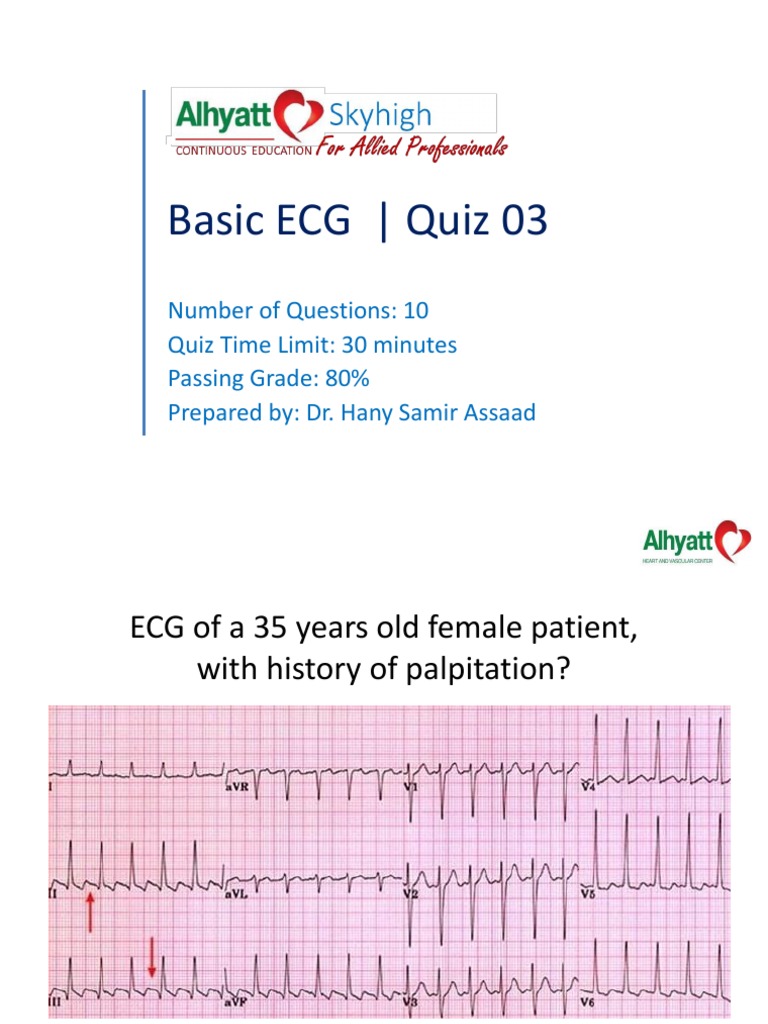 ECG Exam 03 | PDF