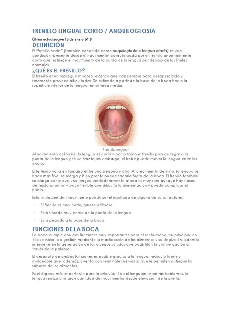 Evaluación del frenillo lingual corto | Lengua | Amamantamiento