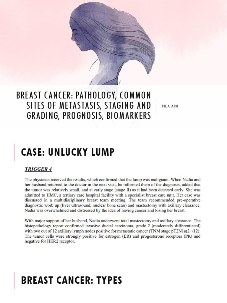 Breast Cancer: Pathology, Common Sites of Metastasis, Staging and ...