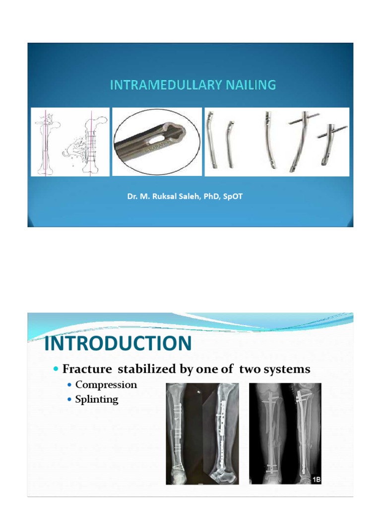 Intramedullary Nailing Edit Animasi | PDF | Musculoskeletal System ...