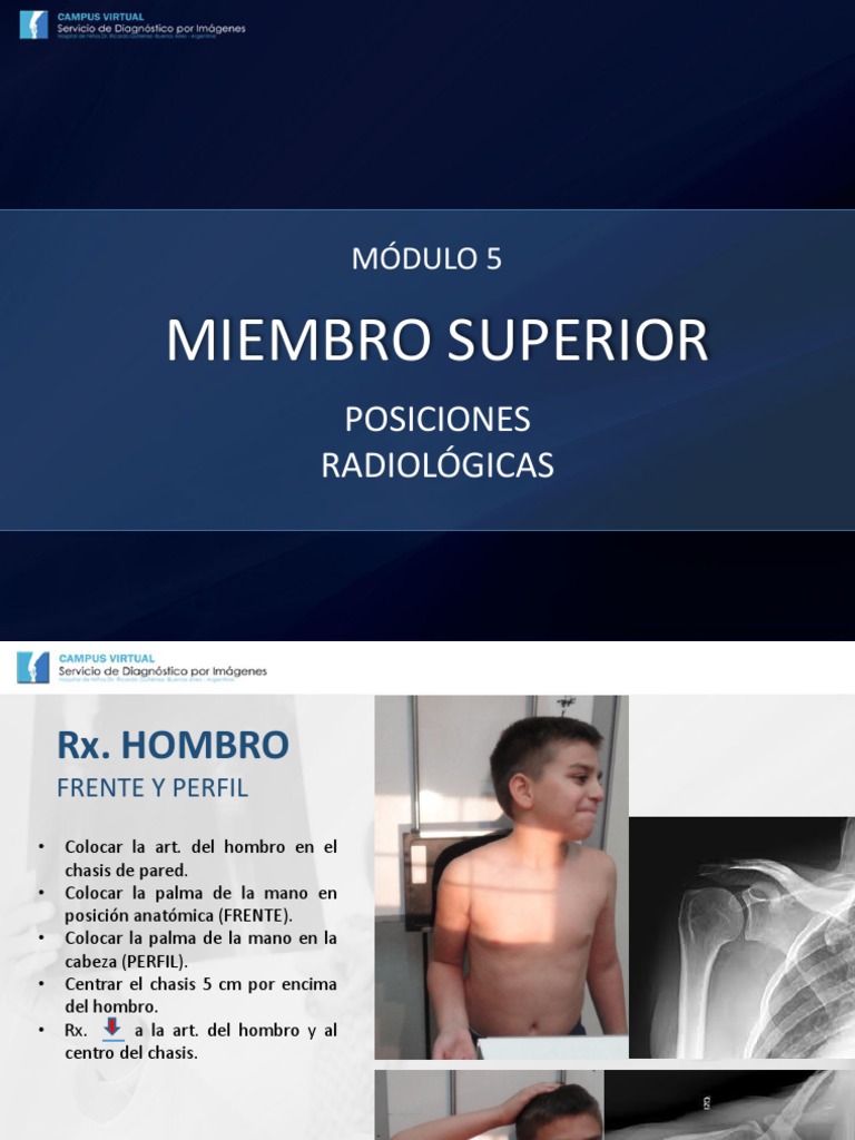 Técnicas Radiológicas de Miembro Superior | PDF | Mano | Hombro