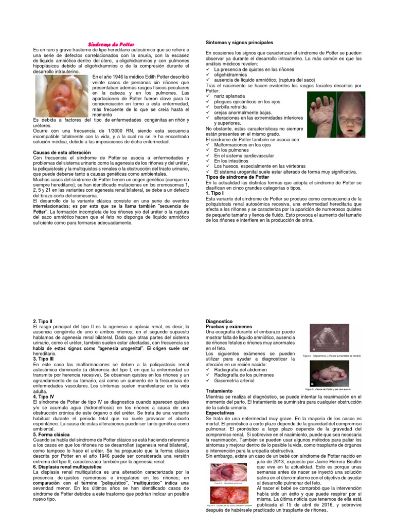 Síndrome de Potter: Causas y Características | PDF | Epidemiología ...