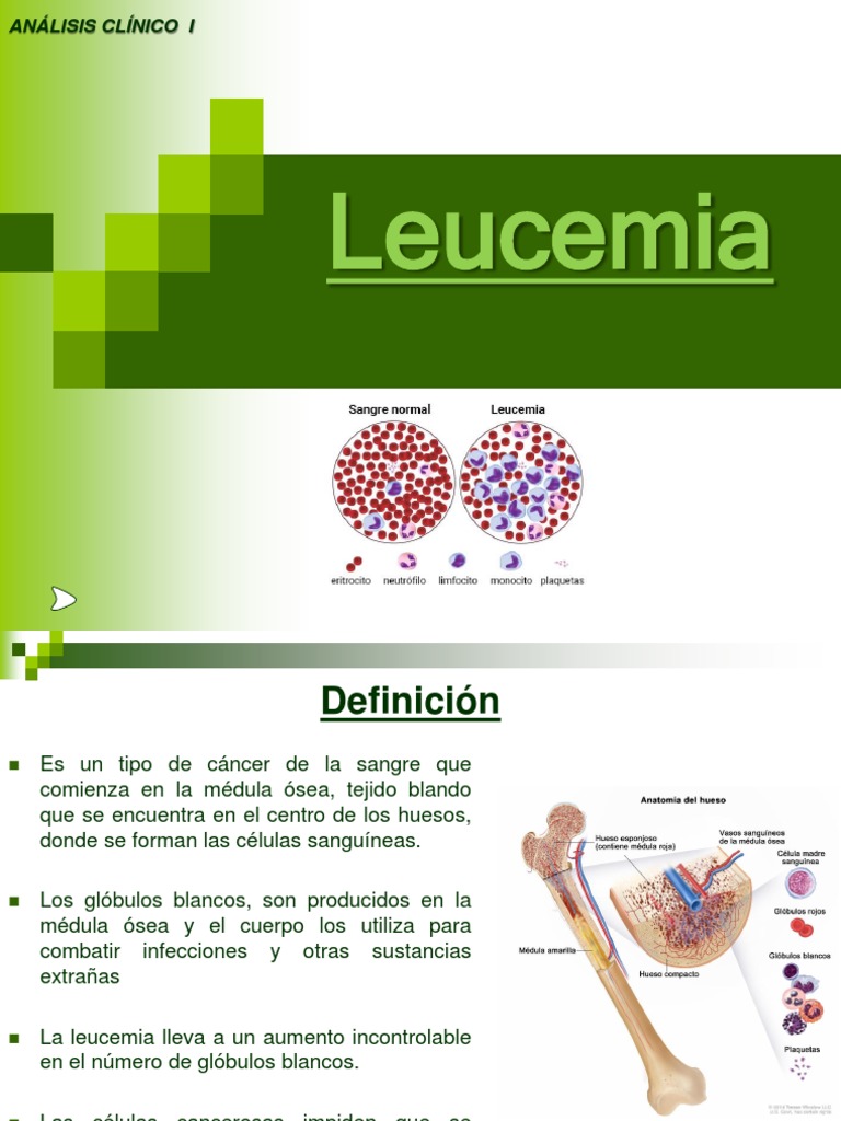 Leucemias | PDF | Leucemia | Leucocito
