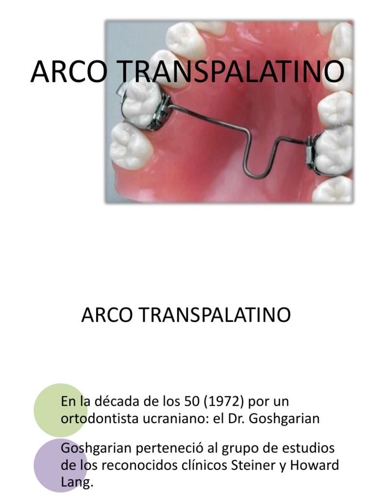 Arco Transpalatino | PDF | Ortodoncia | Diente