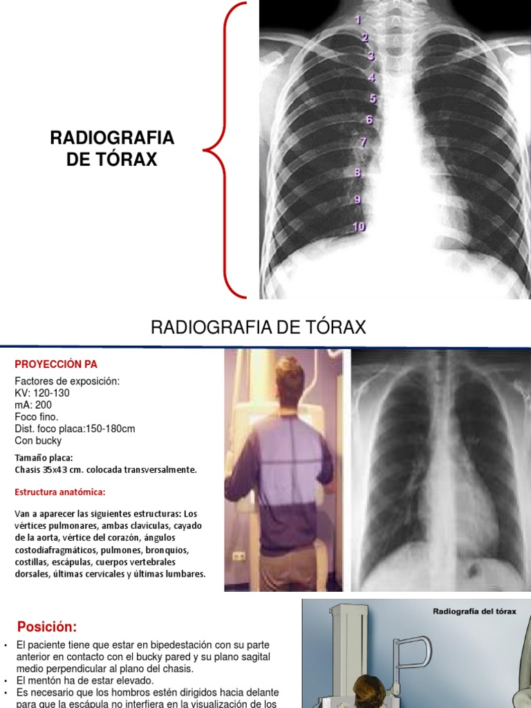 RX Torax | PDF | Tórax | Tórax (anatomía humana)