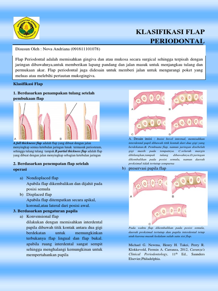 Klasifikasi Flap PRINT | PDF