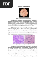 Pathology Outlines - Nonproliferative Fibrocystic Changes | PDF ...