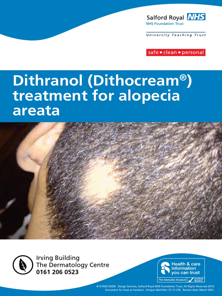 Dithranol (Dithocream) Treatment For Alopecia Areata Mar 19 | PDF ...