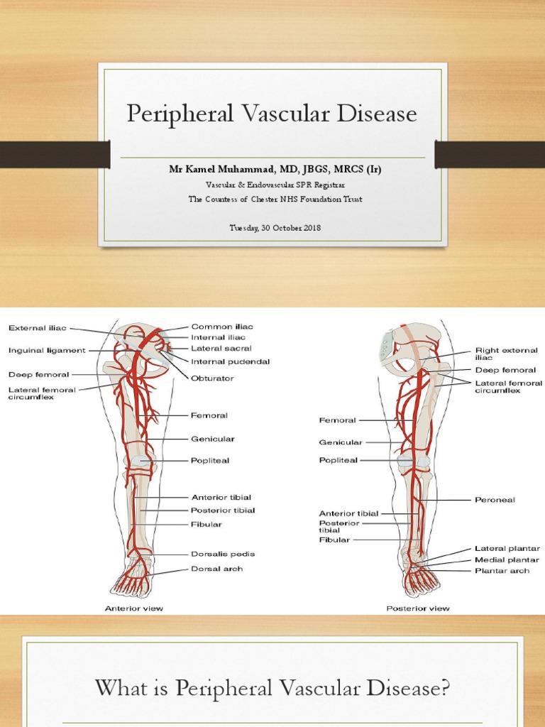 Peripheral Vascular Disease | PDF | Cardiovascular Diseases ...