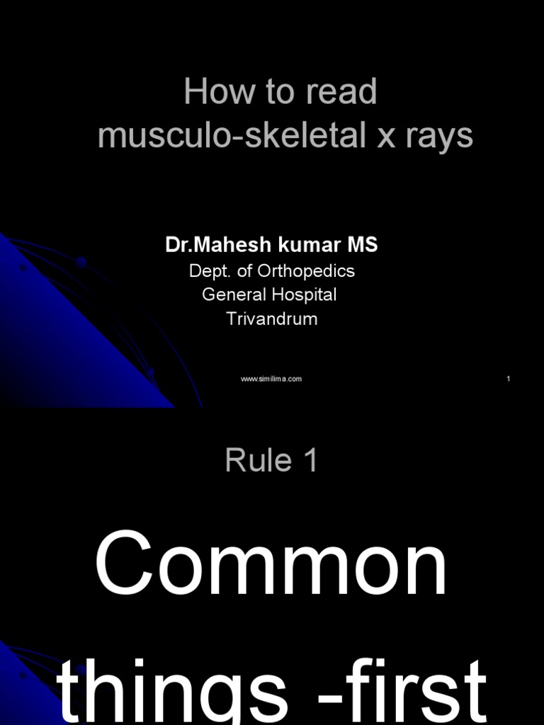 MSK Xray | Download Free PDF | Metastasis | Neoplasms