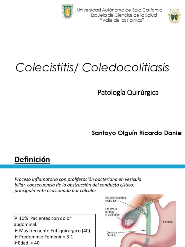 Coledocolitiasis | Gastroenterología | Sistema digestivo