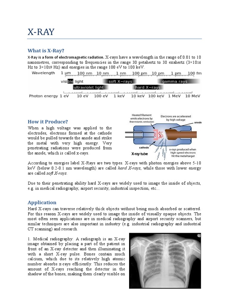 Basic Knowledge About X-Ray | PDF | X Ray | Radiography