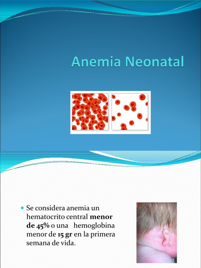 Anemia neonatal-RN PDF | PDF