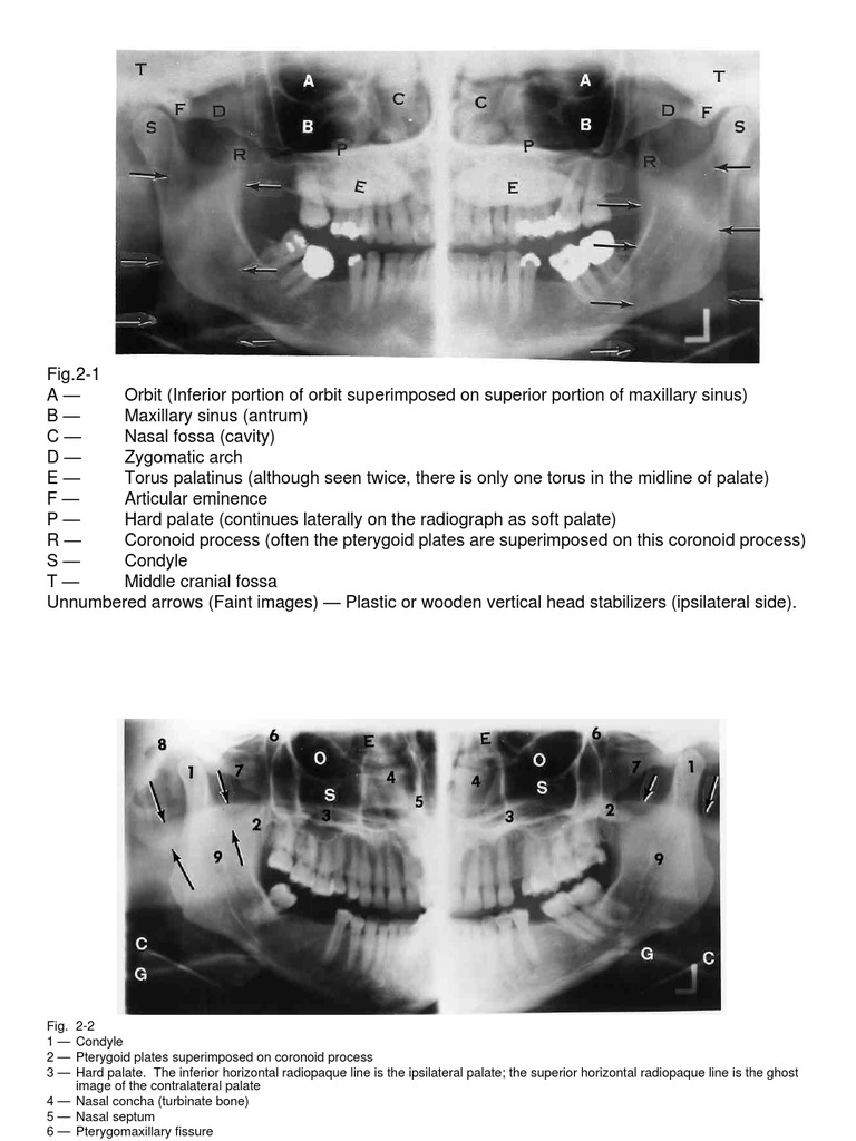 Chapter 02 Panoramic Anatomy | PDF | Anatomical Terms Of Location ...