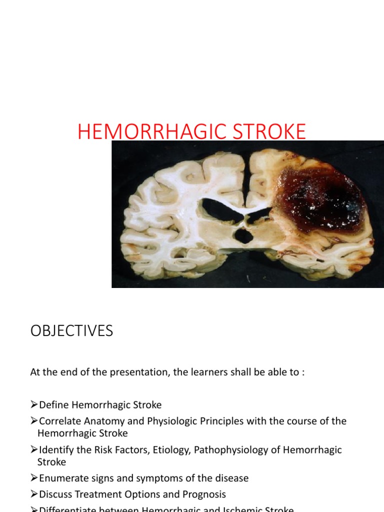 Group 4 - Hemorrhagic Stroke | PDF | Stroke | Angiography