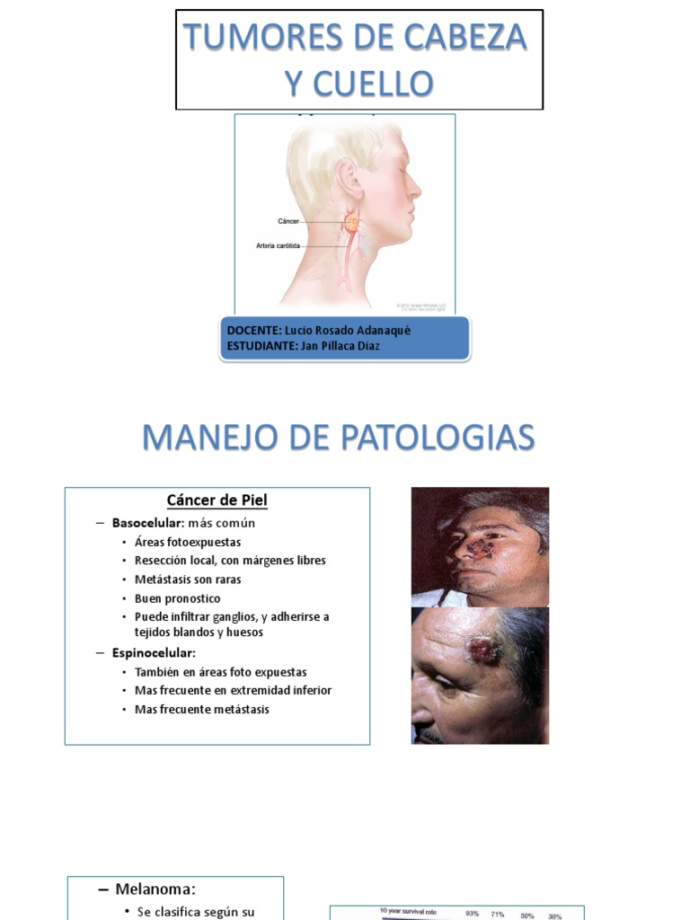 Características clínicas y manejo de tumores de cabeza y cuello | PDF ...