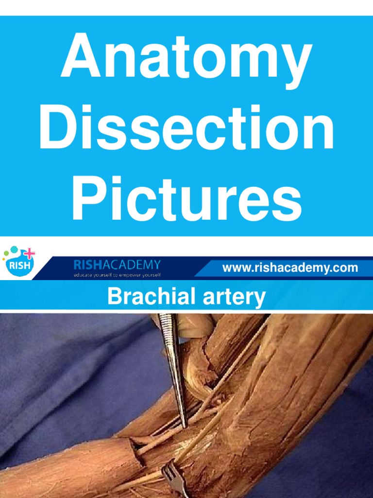 Dissection Anatomy Upper Limb | PDF | Limbs (Anatomy) | Human Anatomy