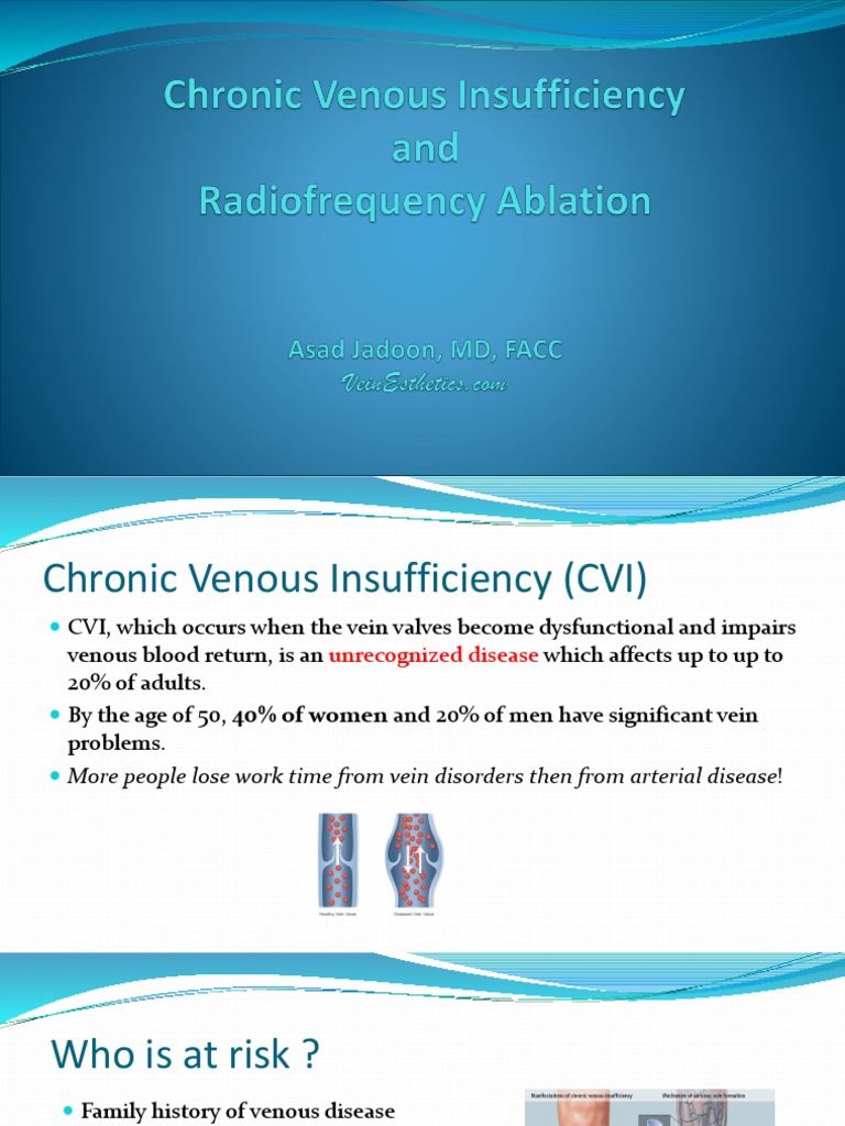 CVI Presentation | PDF | Varicose Veins | Vein