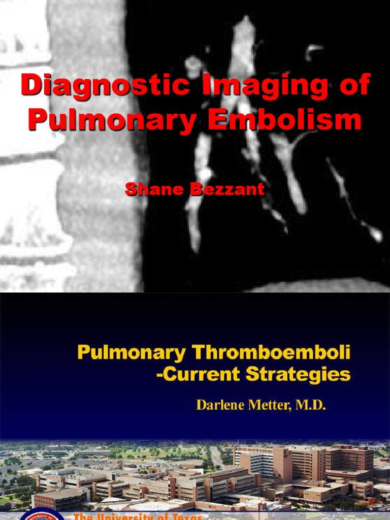 Diagnostic Imaging of Pulmonary Embolism: An Overview of Evaluation ...