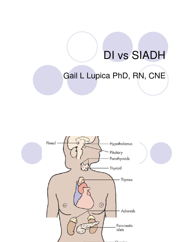 Di Vs Siadh: Gail L Lupica PHD, RN, Cne | PDF | Animal Anatomy ...
