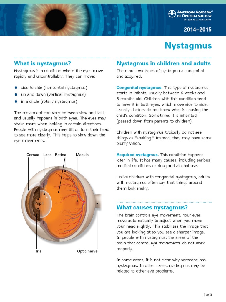 Nystagmus: What Is Nystagmus? Nystagmus in Children and Adults | PDF | Eye | Cataract