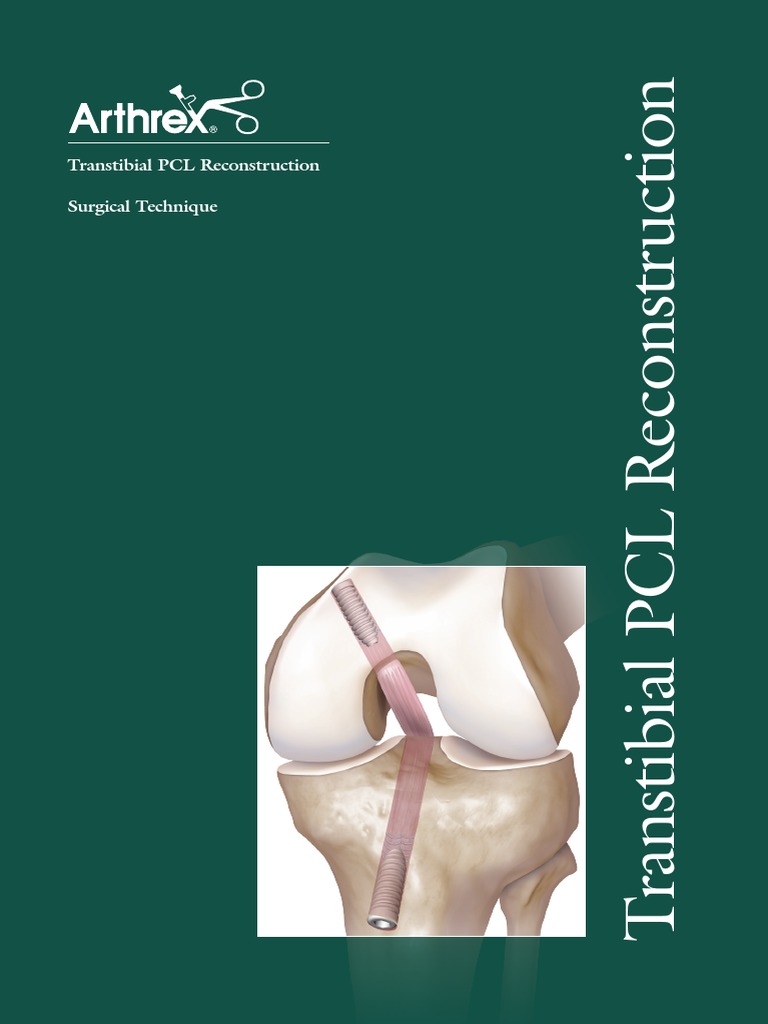 Transtibial PCL Reconstruction Surgical Technique | PDF | Musculoskeletal System | Limbs (Anatomy)