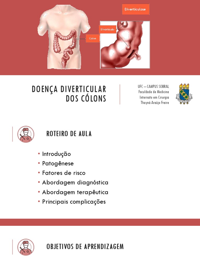 Doença Diverticular Do Colon SLIDE | PDF | Gastroenterologia | RTT