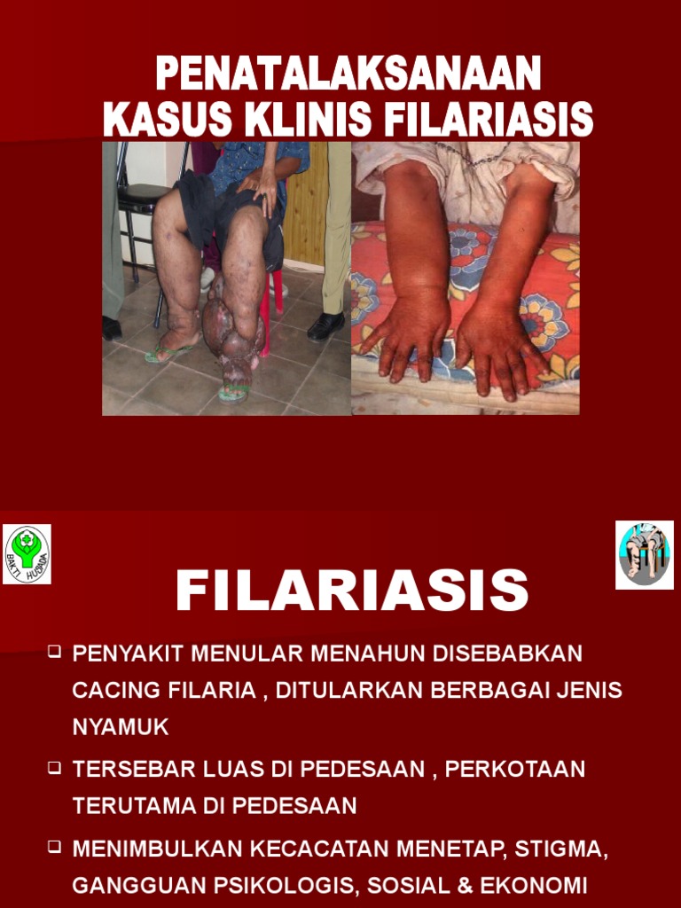 Kasus Kaki Gajah (Elephantiasis) Filaria | PDF
