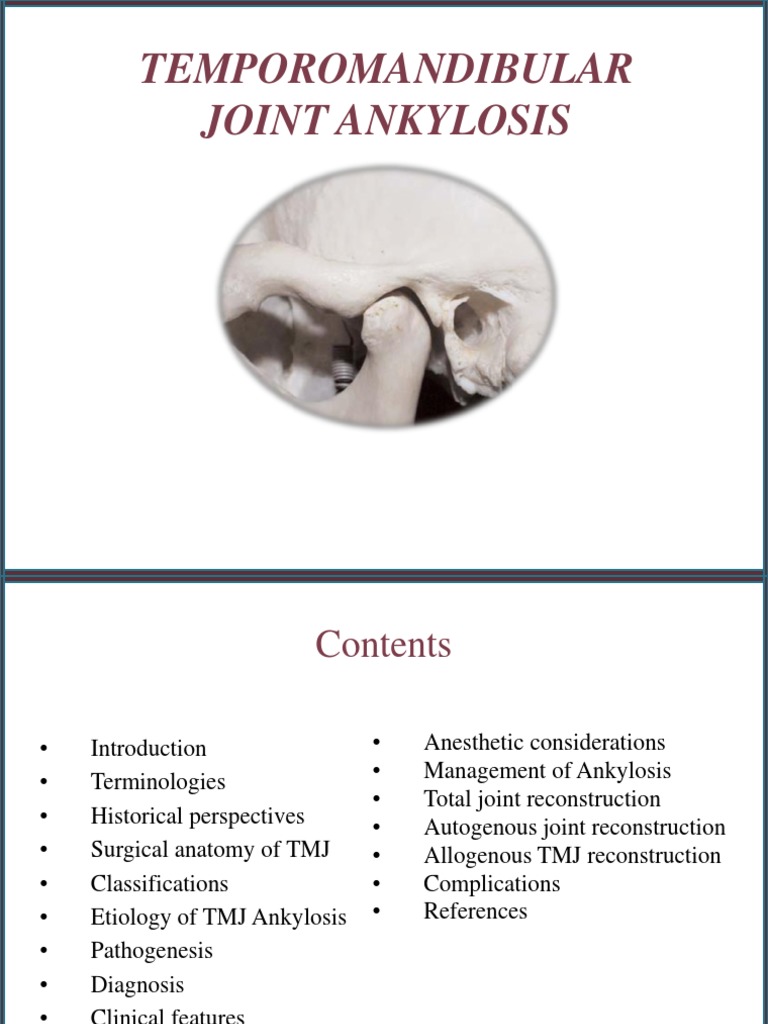 TMJ Ankylosis | PDF | Human Anatomy | Musculoskeletal System
