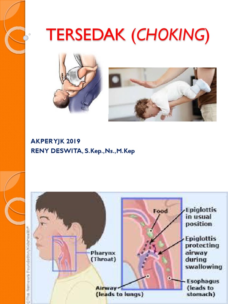 Tersedak Pada Anak | PDF