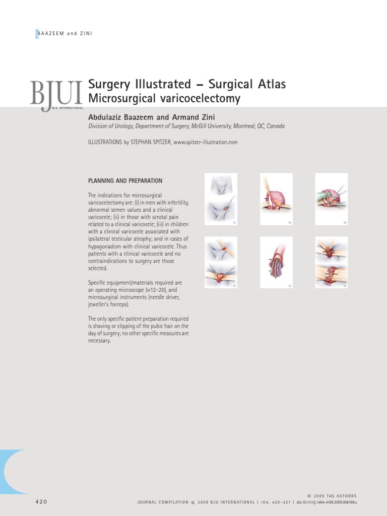 Surgery Illustrated - Surgical Atlas: Microsurgical Varicocelectomy ...
