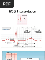 Delta Wave - LITFL Medical Blog - ECG Library Basics | PDF | Cardiac ...