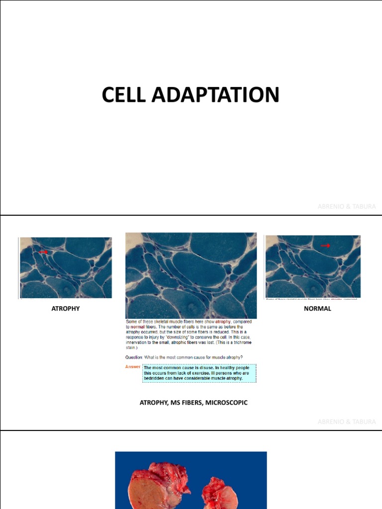 PATHO LAB - CELL ADAPTATION J INJURY and DEATH | PDF | Necrosis | Liver