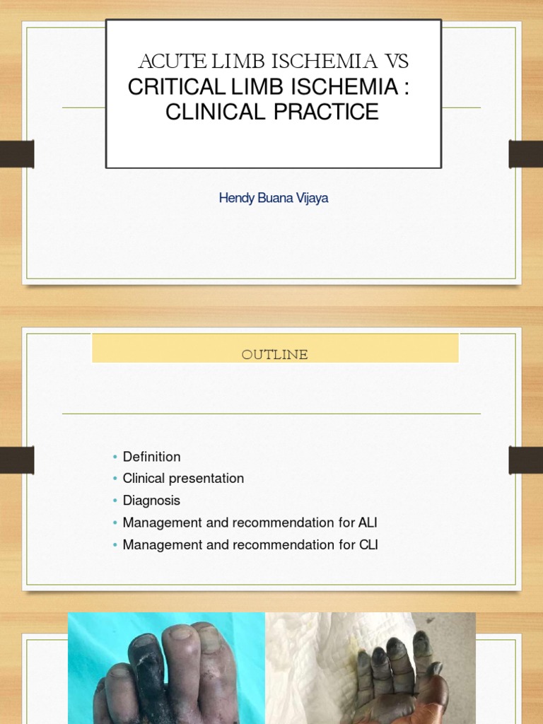 Acute Limb Ischemia Vs Critical Limb Ischemia: Clinical Practice | PDF ...