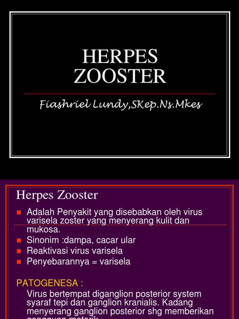 Herpes Zooster Prest | PDF