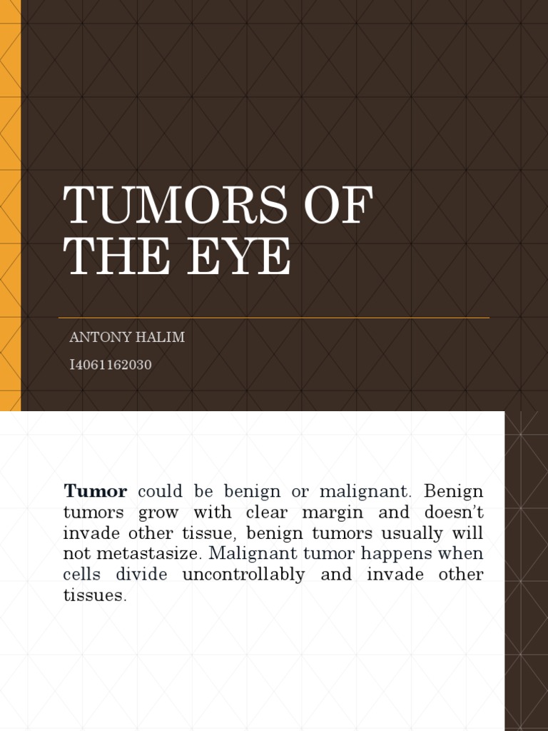 Tumors of The Eye: Antony Halim I4061162030 | PDF | Benign Tumor ...