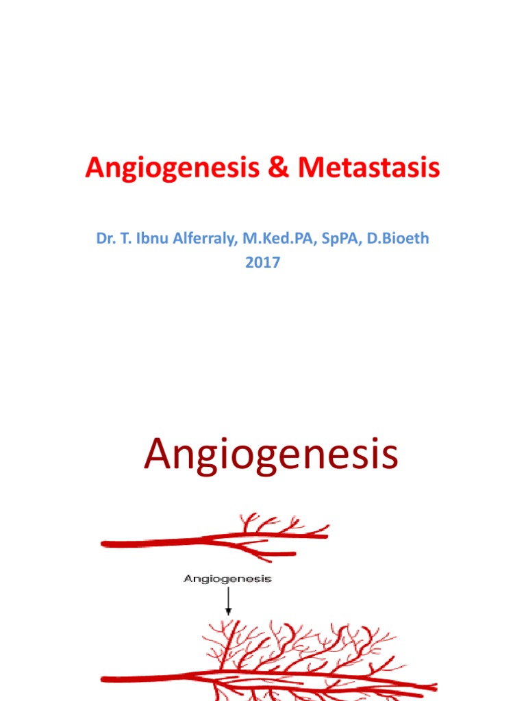 Angiogenesis & Metastasis | PDF | Angiogenesis | Metastasis