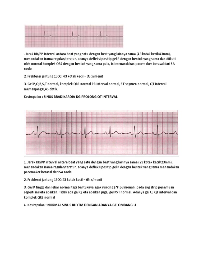 Soal Ekg | PDF