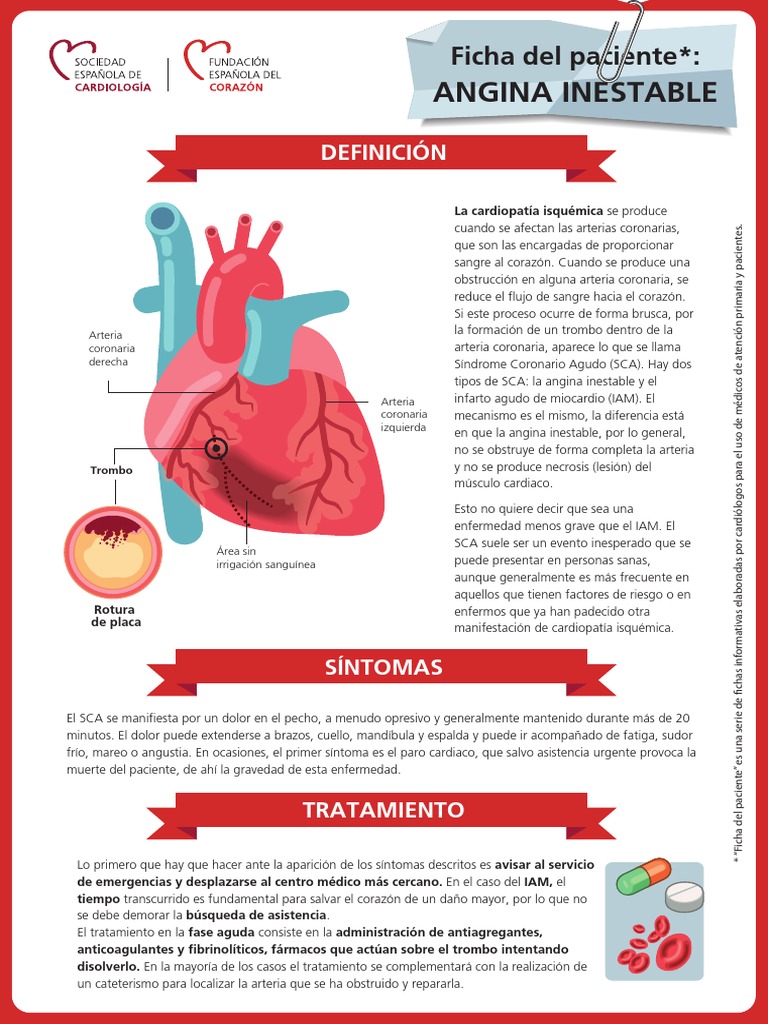 Angina Inestable | PDF | Rtt | Angiología
