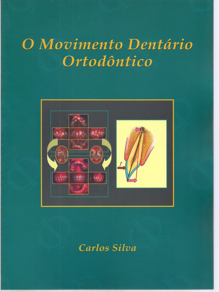 Movimento Dentário Ortodôntico | Dente | Osso
