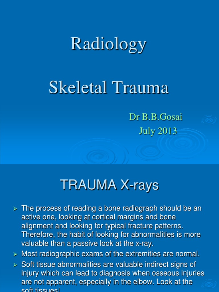 Interpreting Skeletal Trauma: A Guide to Reading Radiographs and ...