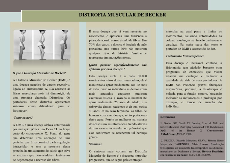Distrofia Muscular De Becker: Tratamento Fisioterapêutico | Distrofia ...