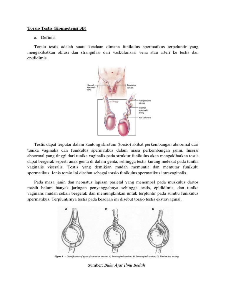 Torsio Testis: Gejala dan Diagnosis | PDF