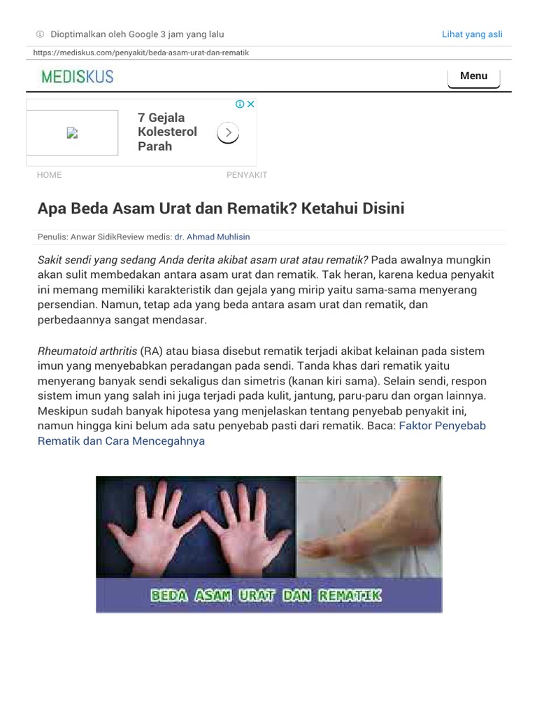 Apa Beda Asam Urat Dan Rematik - Ketahui Disini - Mediskus | PDF