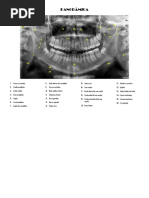 Canino Temporal Superior | PDF | Anatomia dental | Diente