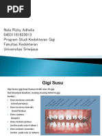 Tabel Waktu Erupsi Gigi | PDF | Seni & Disiplin Bahasa | Kajian Bahasa ...